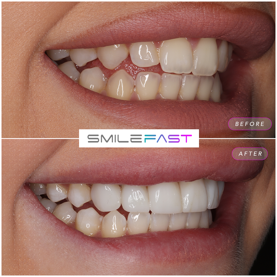 Closeup_2-3 | Vitality Dental Care - Stokesley